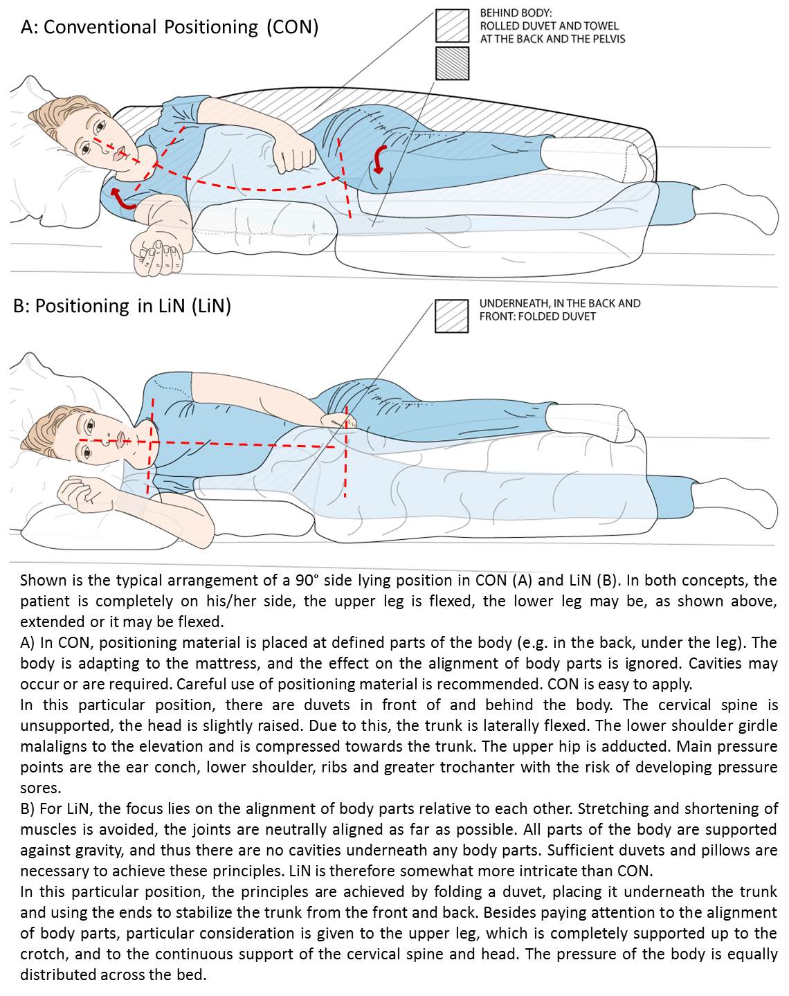 Definition | LiN - Positioning in neutral
